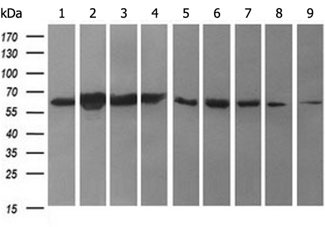 小鼠抗th单克隆抗体anti Th Mouse Monoclonal Antibody 生命科学产品与技术服务 生工生物工程上海股份有限公司