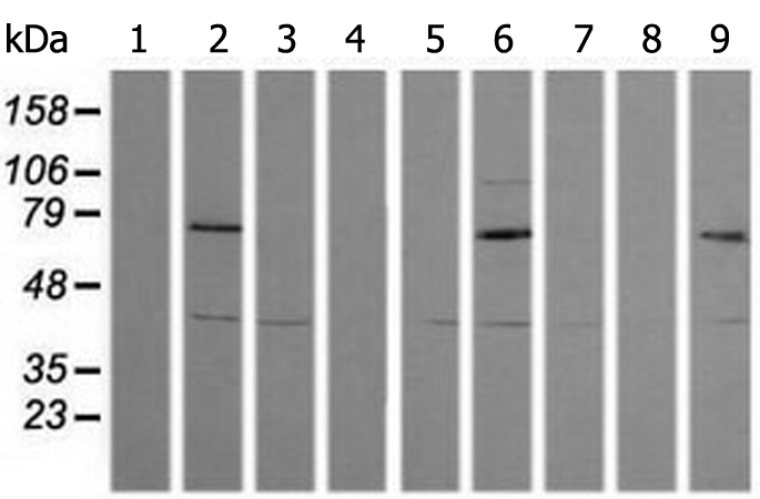 小鼠抗MDM4单克隆抗体,Anti-MDM4 mouse monoclonal antibody 生命科学产品与技术服务-生工生物工程(上海 ...