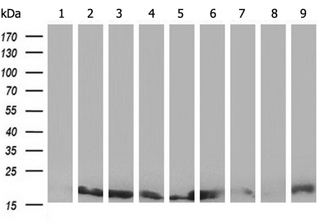 小鼠抗NME2单克隆抗体,Anti-NME2 mouse monoclonal antibody 生命科学产品与技术服务-生工生物工程(上海 ...