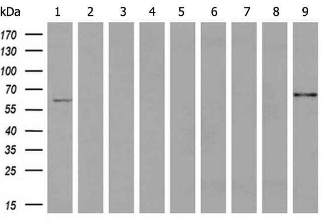 小鼠抗ACSF2单克隆抗体,Anti-ACSF2 mouse monoclonal antibody 生命科学产品与技术服务-生工生物工程 ...