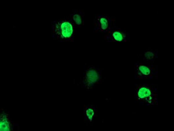 小鼠抗ELK3单克隆抗体,Anti-ELK3 mouse monoclonal antibody 生命科学产品与技术服务-生工生物工程(上海)股份有限公司