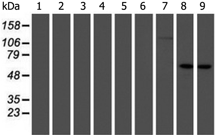 小鼠抗IRF6单克隆抗体,Anti-IRF6 mouse monoclonal antibody 生命科学产品与技术服务-生工生物工程(上海 ...