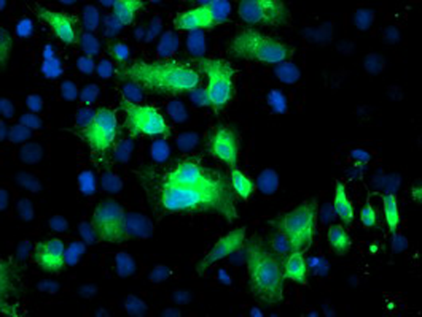 小鼠抗FGFR2单克隆抗体,Anti-FGFR2 mouse monoclonal antibody 生命科学产品与技术服务-生工生物工程 ...