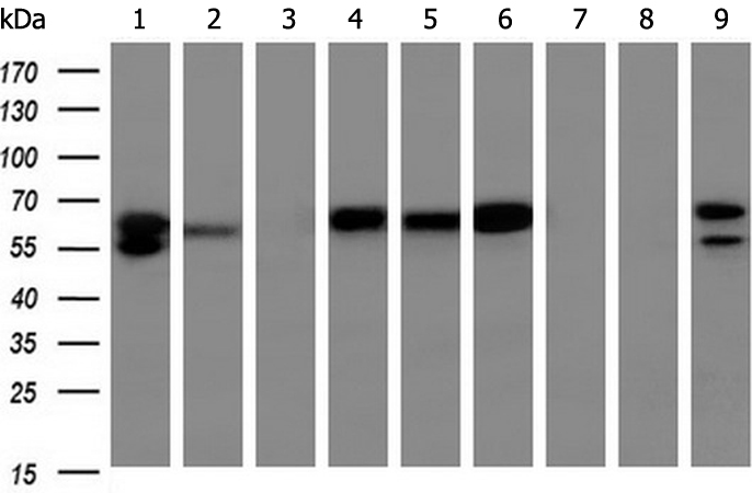 小鼠抗GBP5单克隆抗体,Anti-GBP5 mouse monoclonal antibody 生命科学产品与技术服务-生工生物工程(上海 ...
