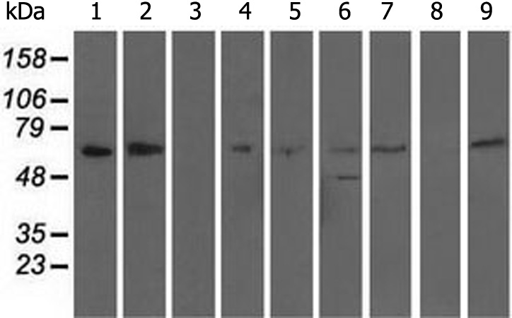 小鼠抗AFP单克隆抗体,Anti-AFP mouse monoclonal antibody 生命科学产品与技术服务-生工生物工程(上海)股份有限公司