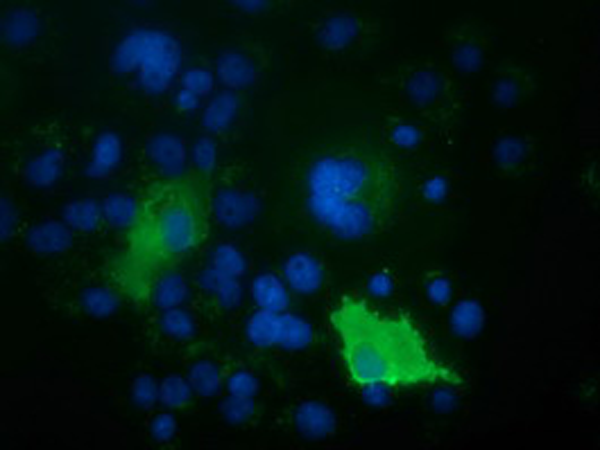 小鼠抗ARHGAP25单克隆抗体,Anti-ARHGAP25 mouse monoclonal antibody 生命科学产品与技术服务-生工 ...