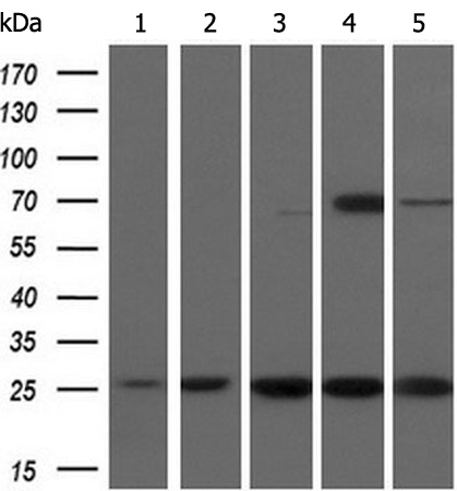 小鼠抗FADD单克隆抗体,Anti-FADD mouse monoclonal antibody 生命科学产品与技术服务-生工生物工程(上海 ...