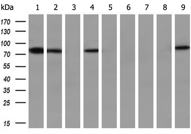 小鼠抗APP单克隆抗体,Anti-APP mouse monoclonal antibody 生命科学产品与技术服务-生工生物工程(上海)股份有限公司
