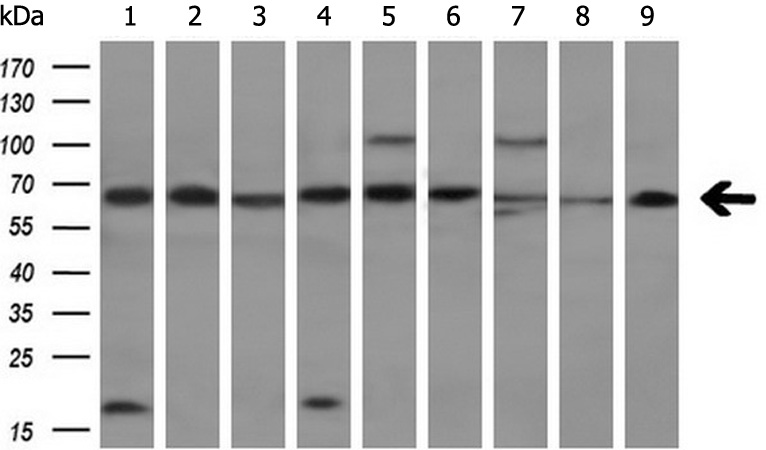 小鼠抗TKT单克隆抗体,Anti-TKT mouse monoclonal antibody 生命科学产品与技术服务-生工生物工程(上海)股份有限公司