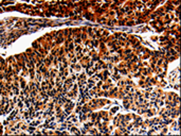 兔抗alox5多克隆抗体anti Alox5 Rabbit Polyclonal Antibody 生命科学产品与技术服务 生工生物工程