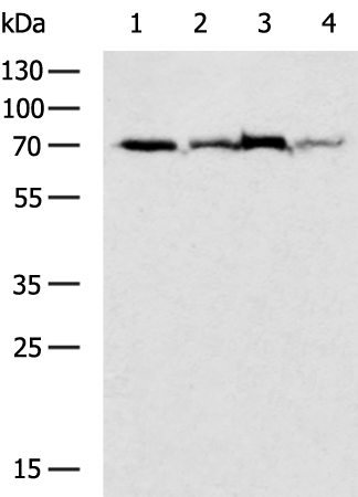 兔抗RELA多克隆抗体,Anti-RELA rabbit polyclonal antibody 生命科学产品与技术服务-生工生物工程(上海 ...