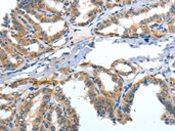 兔抗angpt2多克隆抗体anti Angpt2 Rabbit Polyclonal Antibody 生命科学产品与技术服务 生工生物工程