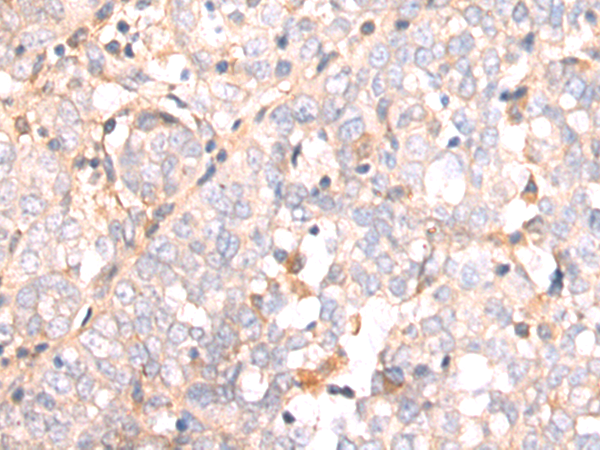 兔抗COL3A1多克隆抗体,Anti-COL3A1 rabbit polyclonal antibody 生命科学产品与技术服务-生工生物工程 ...