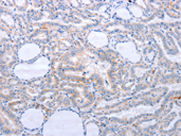 兔抗dnmt3l多克隆抗体anti Dnmt3l Rabbit Polyclonal Antibody 生命科学产品与技术服务 生工生物工程