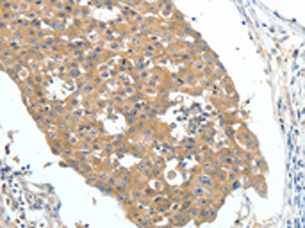 兔抗FSHR多克隆抗体,Anti-FSHR rabbit polyclonal antibody 生命科学产品与技术服务-生工生物工程(上海 ...