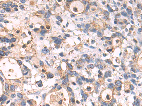 兔抗HSPD1多克隆抗体,Anti-HSPD1 rabbit polyclonal antibody 生命科学产品与技术服务-生工生物工程 ...