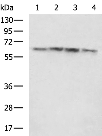 兔抗HSPD1多克隆抗体,Anti-HSPD1 rabbit polyclonal antibody 生命科学产品与技术服务-生工生物工程 ...