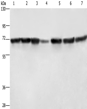 兔抗LMNB1多克隆抗体,Anti-LMNB1 rabbit polyclonal antibody 生命科学产品与技术服务-生工生物工程 ...