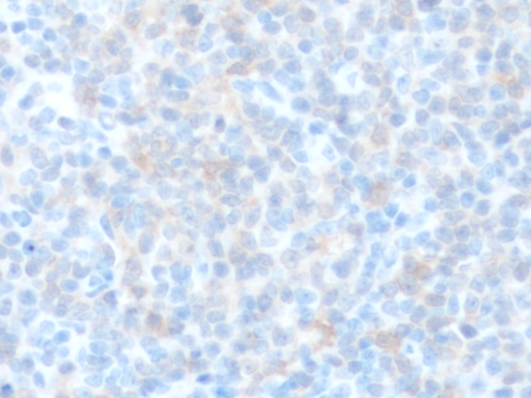 兔抗syk多克隆抗体anti Syk Rabbit Polyclonal Antibody 生命科学产品与技术服务 生工生物工程上海股份有限公司