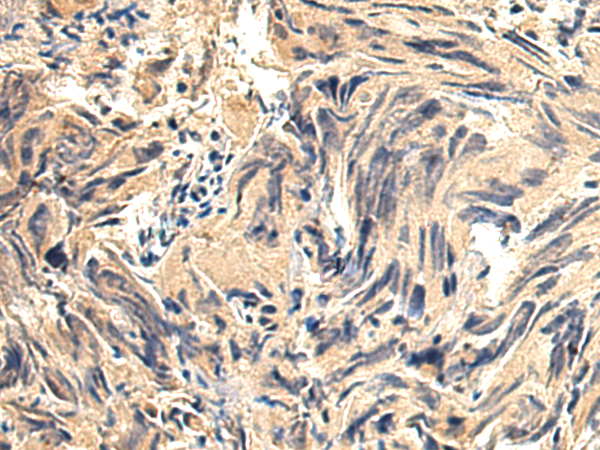 兔抗cd200r1多克隆抗体anti Cd200r1 Rabbit Polyclonal Antibody 生命科学产品与技术服务 生工生物