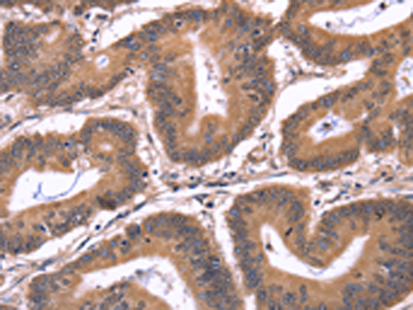 兔抗crk多克隆抗体anti Crk Rabbit Polyclonal Antibody 生命科学产品与技术服务 生工生物工程上海股份有限公司