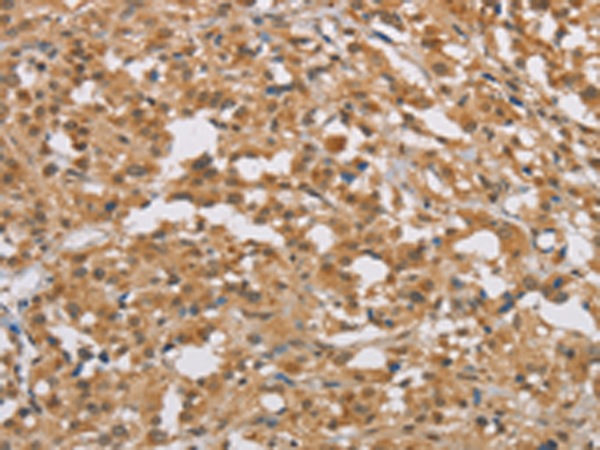 兔抗DIDO1多克隆抗体,Anti-DIDO1 rabbit polyclonal antibody 生命科学产品与技术服务-生工生物工程 ...