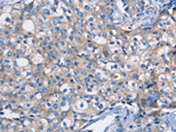 兔抗DMD多克隆抗体,Anti-DMD rabbit polyclonal antibody 生命科学产品与技术服务-生工生物工程(上海)股份有限公司