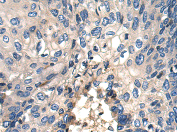 兔抗eda多克隆抗体anti Eda Rabbit Polyclonal Antibody 生命科学产品与技术服务 生工生物工程上海股份有限公司