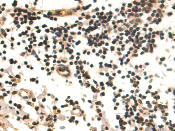 兔抗fto多克隆抗体anti Fto Rabbit Polyclonal Antibody 生命科学产品与技术服务 生工生物工程上海股份有限公司