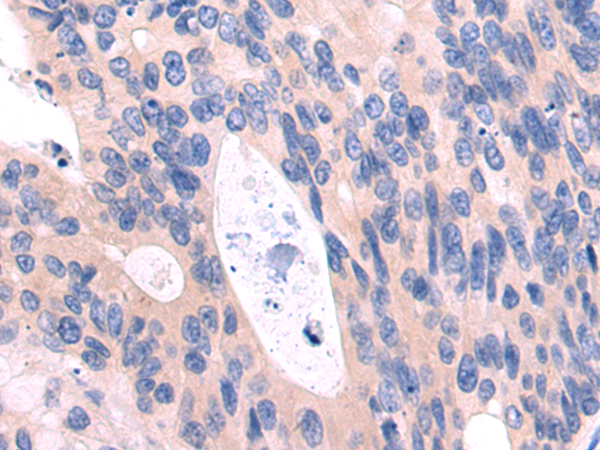 兔抗LRRC15多克隆抗体 Anti-LRRC15 rabbit polyclonal antibody 生命科学产品与技术服务-生工生物工程 ...