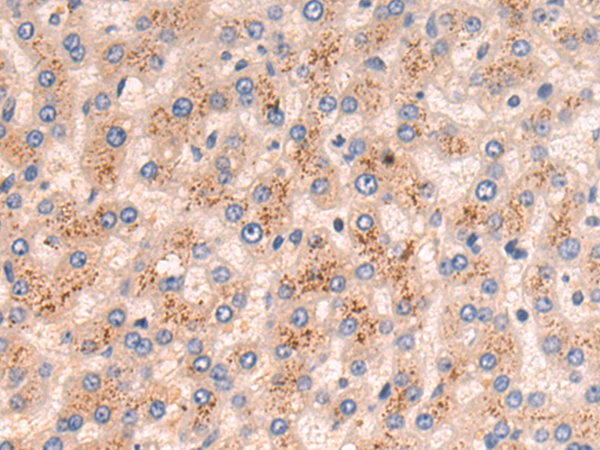 兔抗RFFL多克隆抗体,Anti-RFFL rabbit polyclonal antibody 生命科学产品与技术服务-生工生物工程(上海 ...