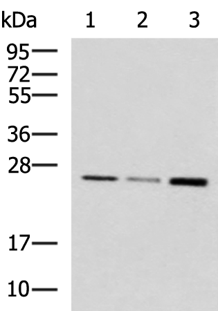 兔抗NUDT21多克隆抗体,Anti-NUDT21 rabbit polyclonal antibody 生命科学产品与技术服务-生工生物工程 ...