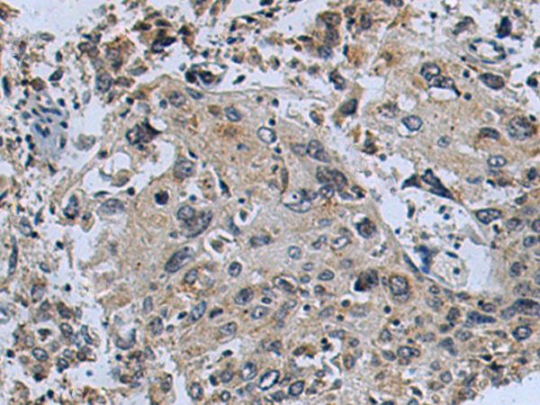 兔抗fam3d多克隆抗体anti Fam3d Rabbit Polyclonal Antibody 生命科学产品与技术服务 生工生物工程