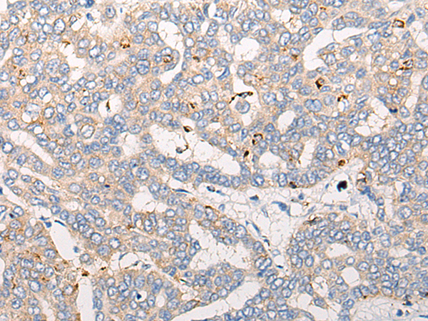 兔抗COL11A1多克隆抗体,Anti-COL11A1 rabbit polyclonal antibody 生命科学产品与技术服务-生工生物 ...