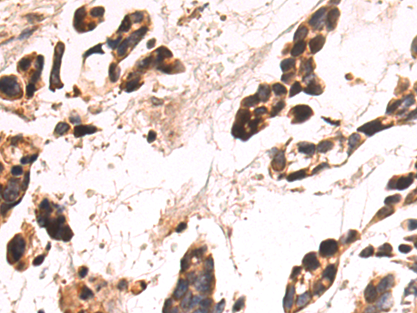 兔抗znf707多克隆抗体anti Znf707 Rabbit Polyclonal Antibody 生命科学产品与技术服务 生工生物工程