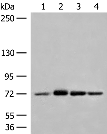 兔抗MCCC1多克隆抗体,Anti-MCCC1 rabbit polyclonal antibody 生命科学产品与技术服务-生工生物工程 ...