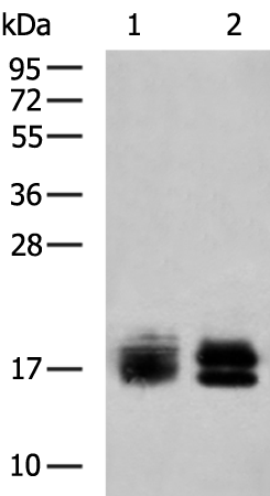 兔抗NPC2多克隆抗体,Anti-NPC2 rabbit polyclonal antibody 生命科学产品与技术服务-生工生物工程(上海 ...