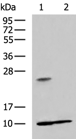 兔抗RPS27A多克隆抗体,Anti-RPS27A rabbit polyclonal antibody 生命科学产品与技术服务-生工生物工程 ...