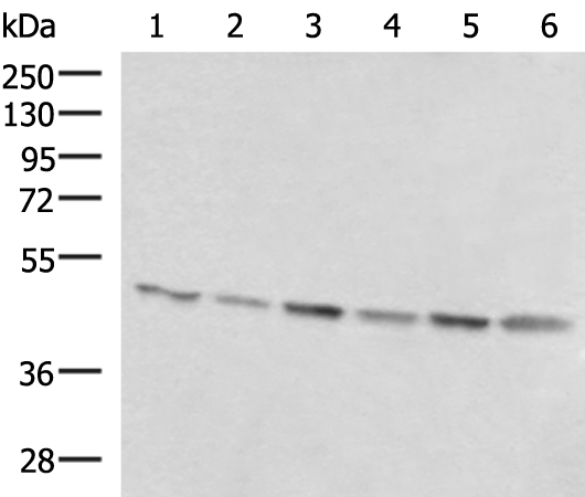 兔抗RHAG多克隆抗体,Anti-RHAG rabbit polyclonal antibody 生命科学产品与技术服务-生工生物工程(上海 ...