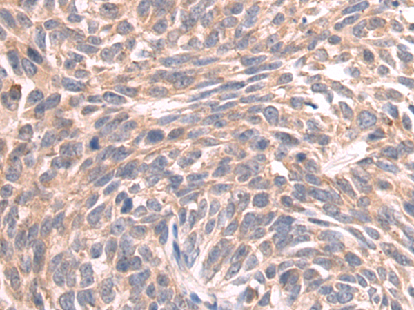 兔抗MID1多克隆抗体,Anti-MID1 rabbit polyclonal antibody 生命科学产品与技术服务-生工生物工程(上海 ...