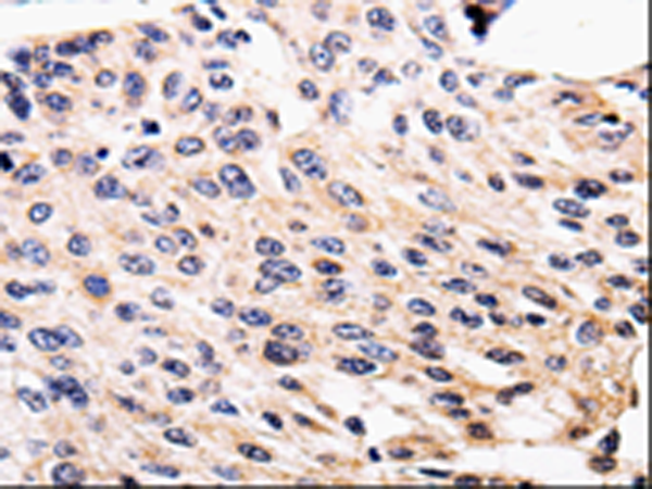 兔抗alk多克隆抗体anti Alk Rabbit Polyclonal Antibody 生命科学产品与技术服务 生工生物工程上海股份有限公司