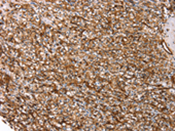 兔抗aqp1多克隆抗体anti Aqp1 Rabbit Polyclonal Antibody 生命科学产品与技术服务 生工生物工程上海