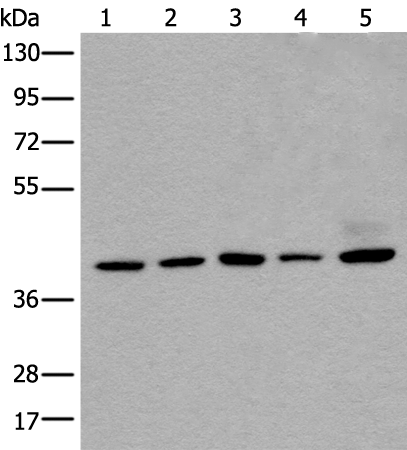 兔抗ESR2多克隆抗体 Anti-ESR2 rabbit polyclonal antibody 生命科学产品与技术服务-生工生物工程(上海 ...