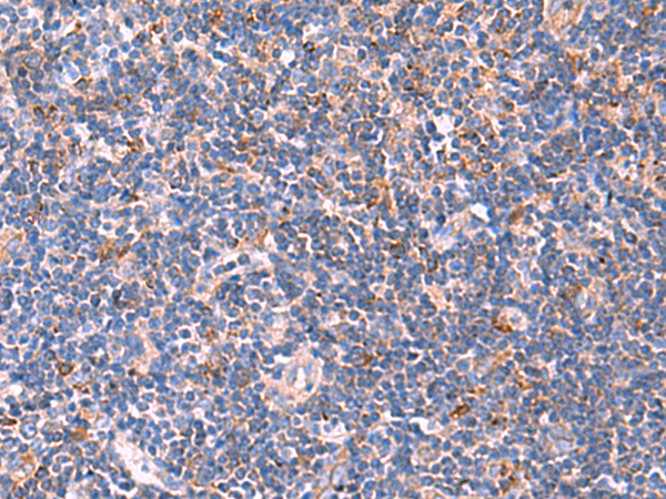 兔抗SLC2A3多克隆抗体,Anti-SLC2A3 rabbit polyclonal antibody 生命科学产品与技术服务-生工生物工程 ...