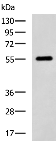 兔抗LAYN多克隆抗体,Anti-LAYN rabbit polyclonal antibody 生命科学产品与技术服务-生工生物工程(上海 ...