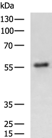 兔抗ALPG多克隆抗体,Anti-ALPG rabbit polyclonal antibody 生命科学产品与技术服务-生工生物工程(上海 ...