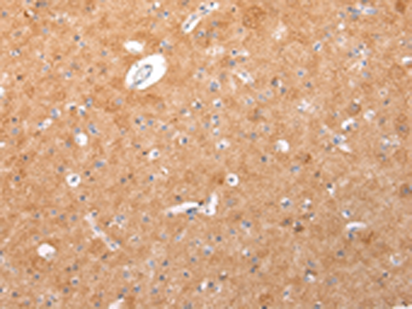 兔抗Lambda Light chain多克隆抗体 Anti-Lambda Light chain rabbit polyclonal antibody 生命科学产品与技术服务-生工生物工程 ...