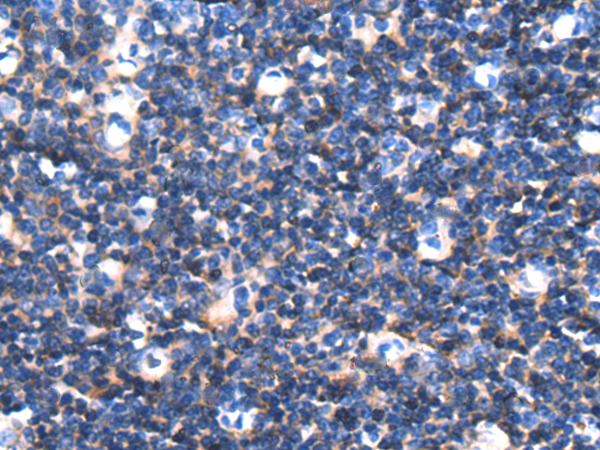 兔抗ptprc多克隆抗体anti Ptprc Rabbit Polyclonal Antibody 生命科学产品与技术服务 生工生物工程