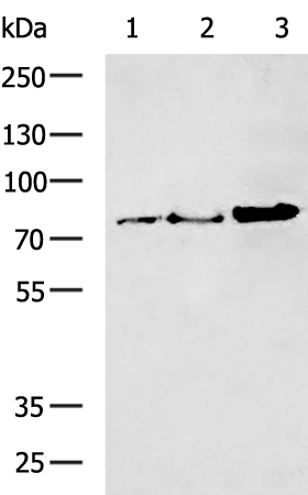 兔抗PLA2G4B多克隆抗体 Anti-PLA2G4B rabbit polyclonal antibody 生命科学产品与技术服务-生工生物 ...
