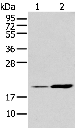兔抗IL17D多克隆抗体,Anti-IL17D rabbit polyclonal antibody 生命科学产品与技术服务-生工生物工程 ...